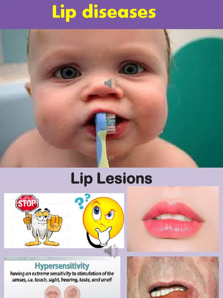 Lip Diseases | PDF | Diseases And Disorders | Medical Specialties