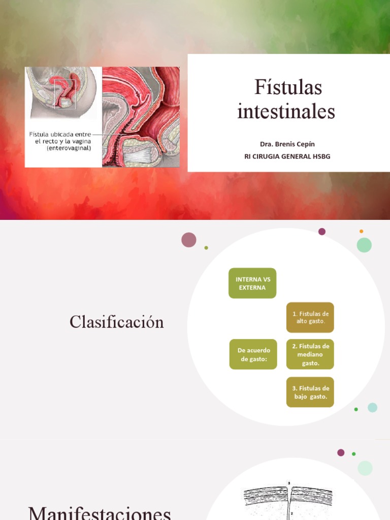 Clasificación y diagnóstico de fístulas intestinales | PDF