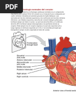 ACLS - 5h 5T | PDF | Infarto de miocardio | Reanimación cardiopulmonar