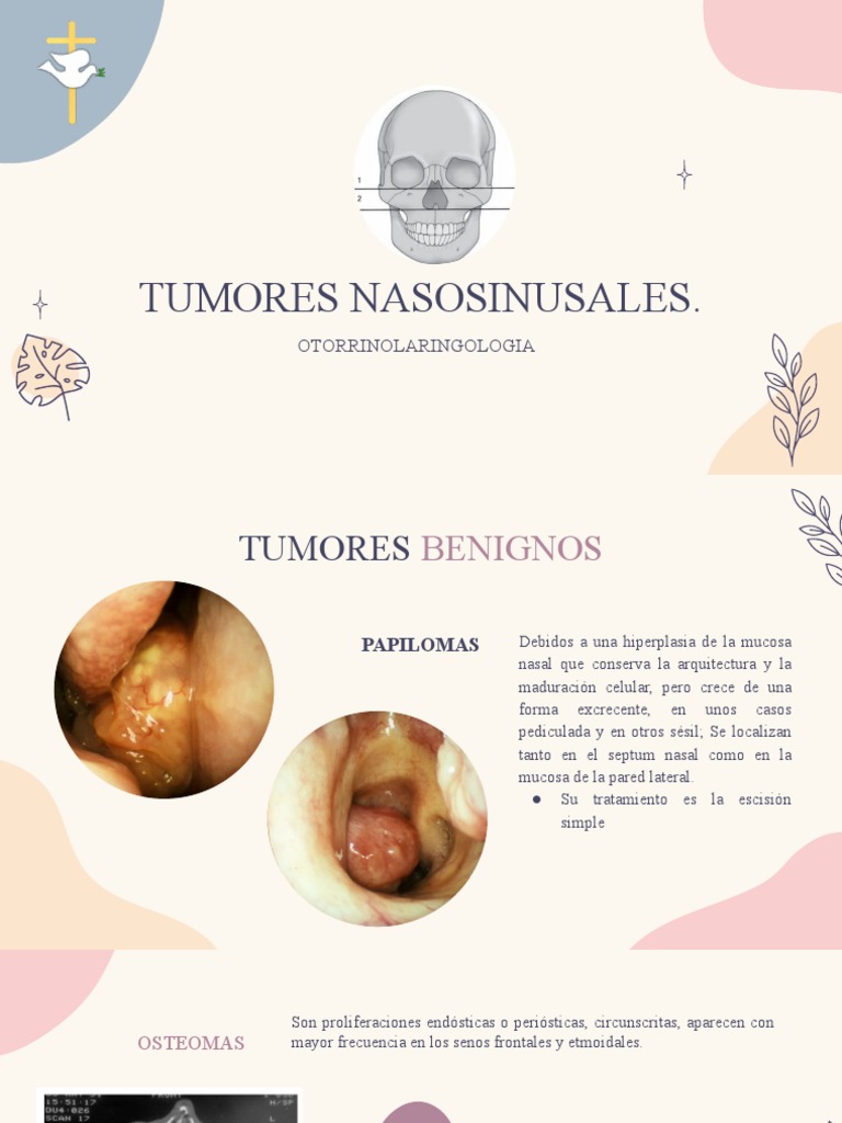Tumores Nasosinusales. | PDF | Cáncer | Especialidades Medicas