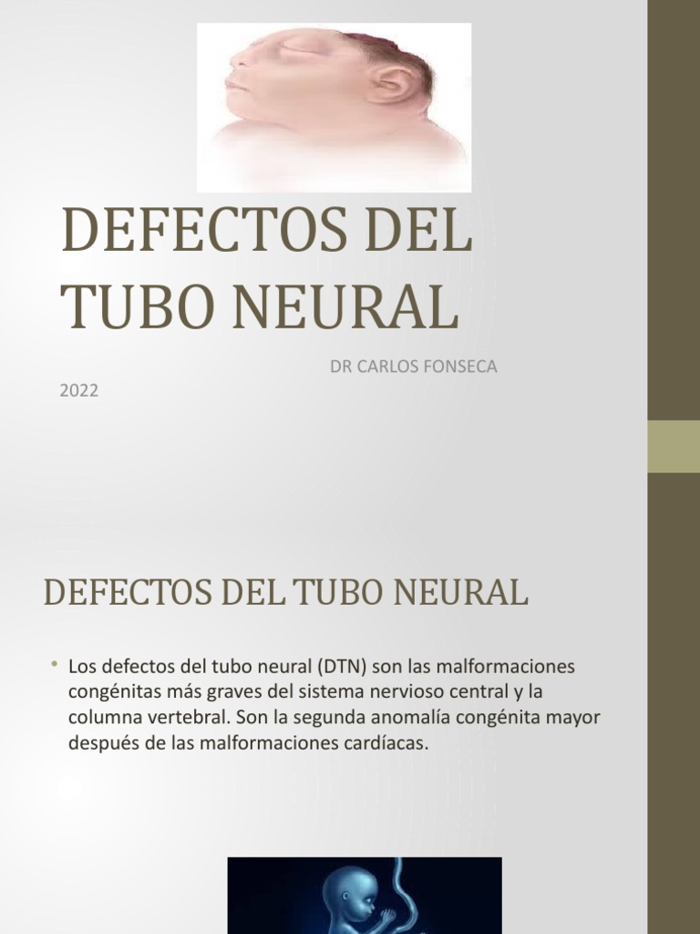 Defectos Del Tubo Neural | PDF | Fluido cerebroespinal | Enfermedades y ...