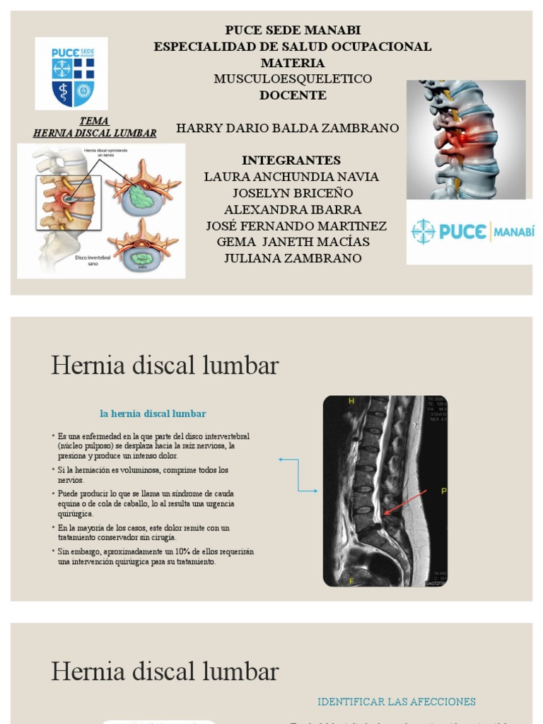 Hernia Discal Lumbar | PDF | Dolor lumbar | Medicina