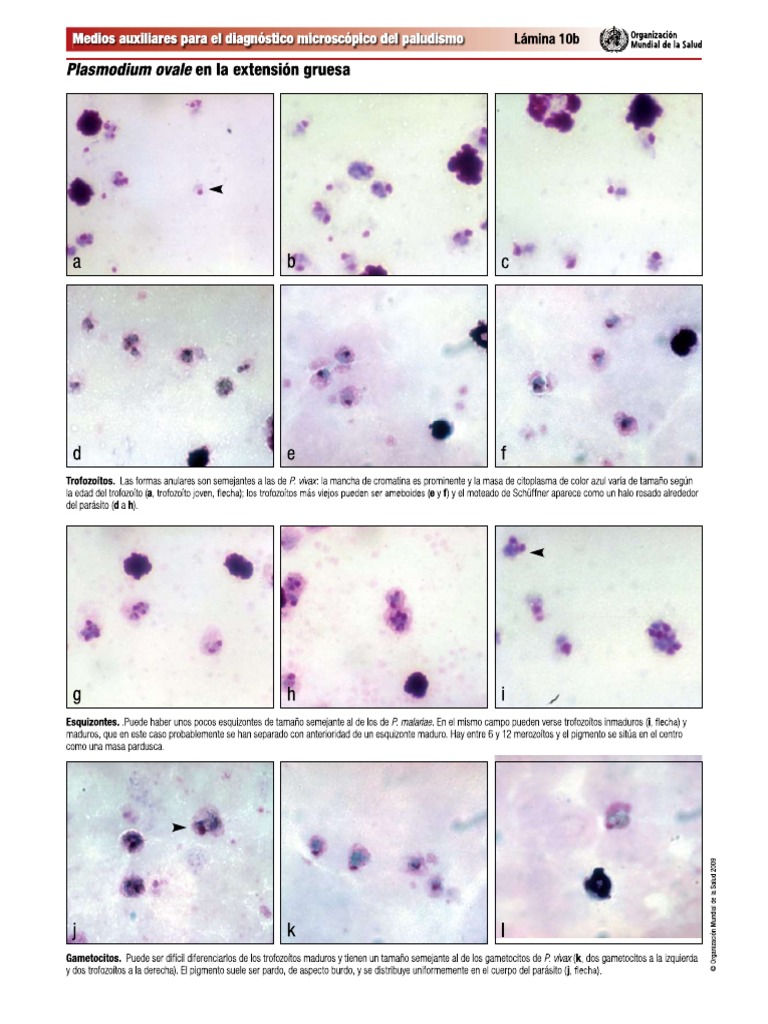 P. Ovale Extension Gruesa | PDF