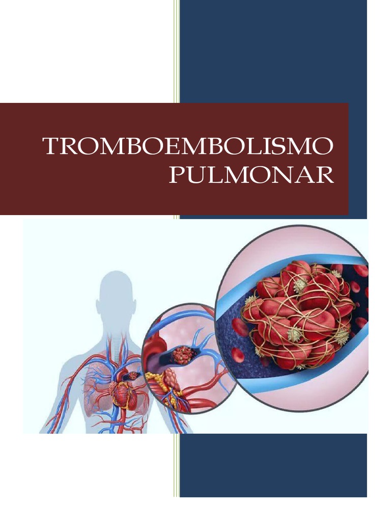 TROMBOEMBOLISMO - PULMONAR (Primera Revision) | PDF | Trombo | Sistema ...