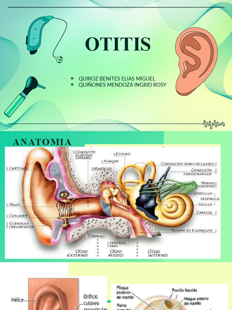 Otitis | PDF | Oído | Escuchando