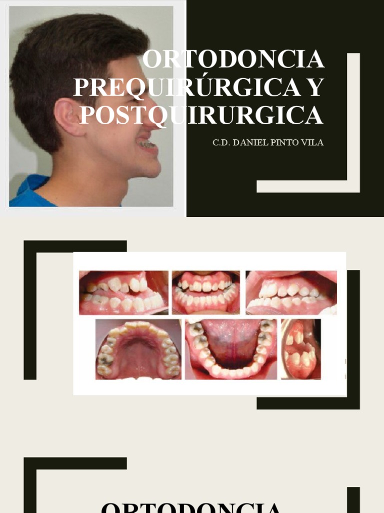 Ortodoncia Pre y Postquirurgica | PDF | Ortodoncia | Ramas de Odontología
