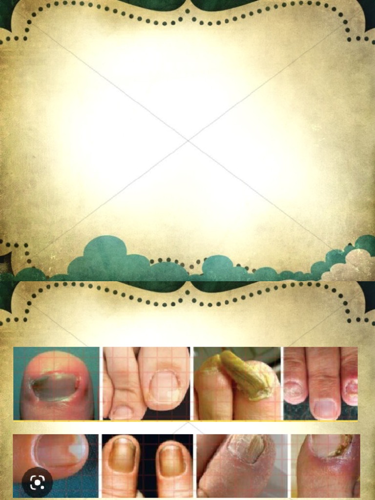 Overview of Nail Diseases and Disorders | PDF | Nail (Anatomy ...
