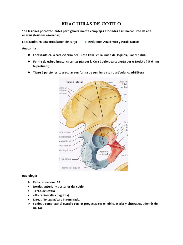 Fracturas de Cotilo | PDF | Pelvis | Sistema esquelético