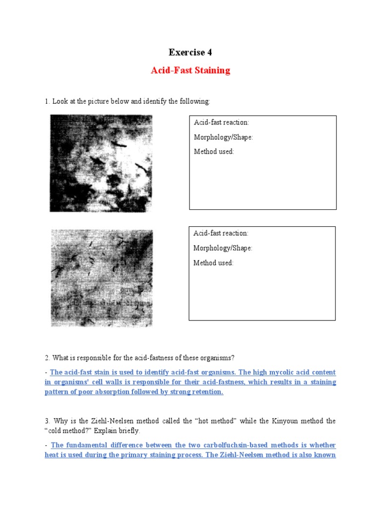 Acid-Fast Staining: Exercise 4 | PDF | Staining | Histopathology