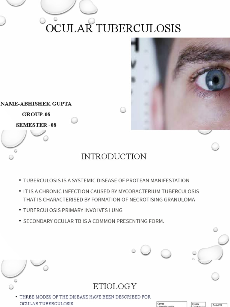 Abhishek PPT On TB of Eyes | PDF | Tuberculosis | Human Eye