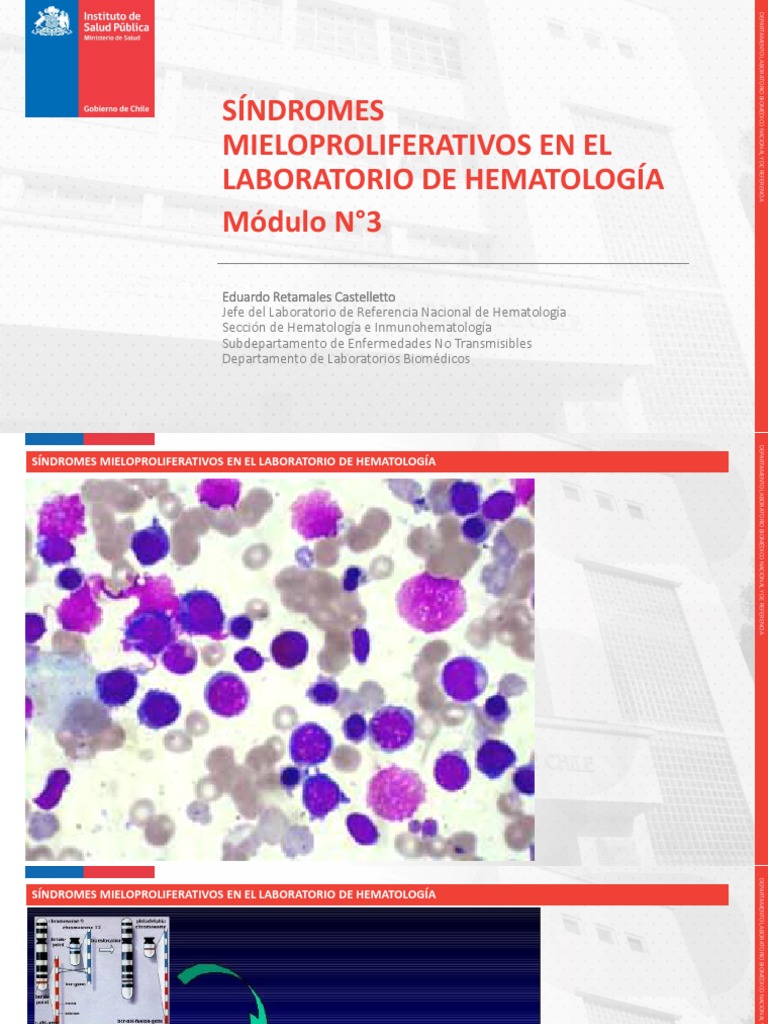 Módulo III - Interp. Sindromes Mieloproliferativos Lab Hematología Rec. ISP | PDF
