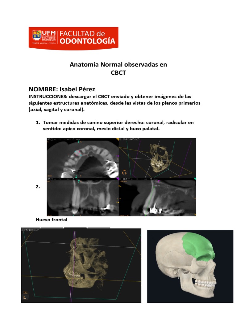 Anatomía Normal en CBCT | PDF