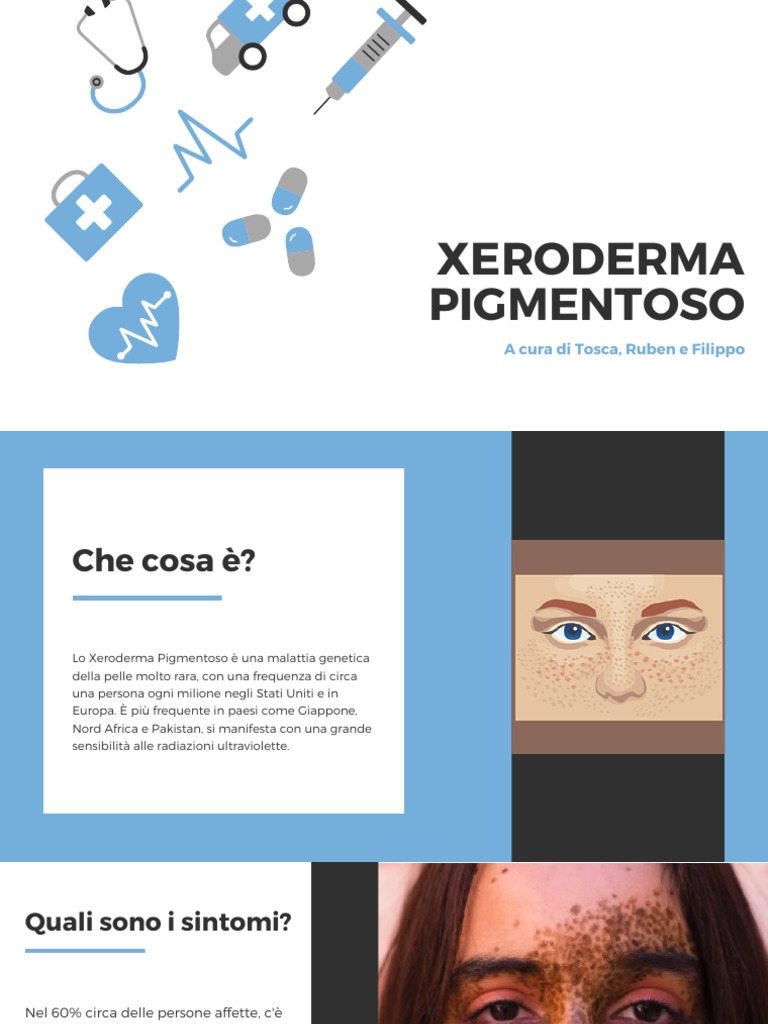 Xeroderma Pigmentoso | PDF