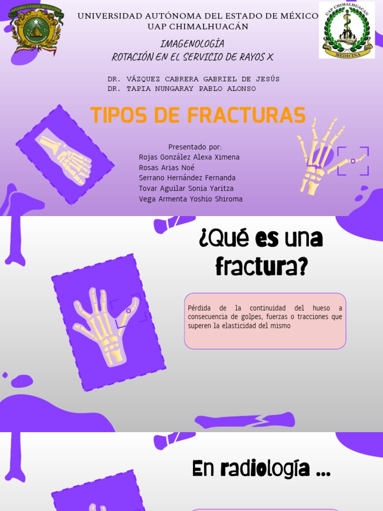 Tipos de Fracturas | PDF | Hueso | Fractura