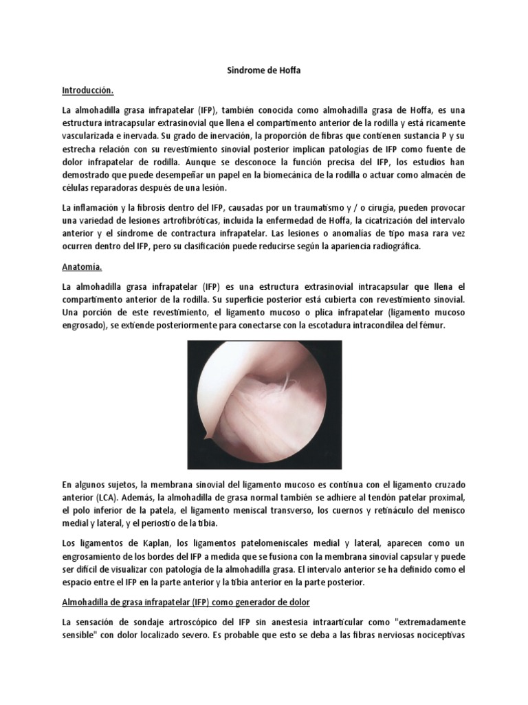 Síndrome de Hoffa: Dolor y Tratamiento | PDF | Rodilla | Inflamación