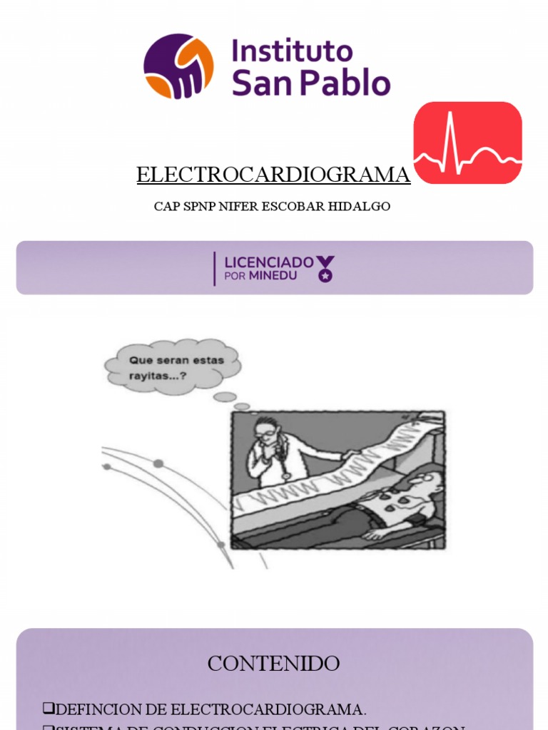 Electrocardiograma: Cap SPNP Nifer Escobar Hidalgo | PDF