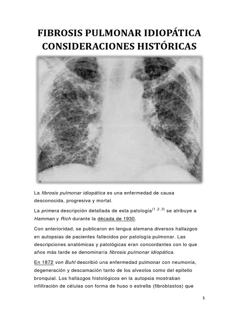 Fibrosis Pulmonar Idiopática. Consideraciones Históricas. | PDF | Tos ...