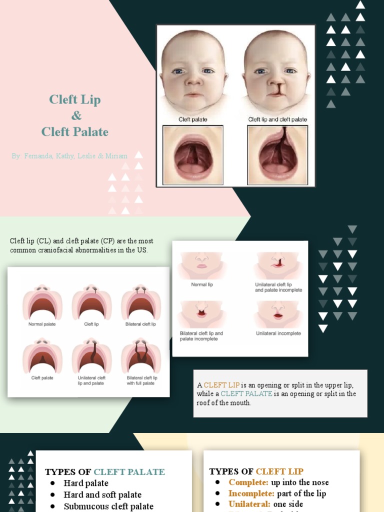 Cleft Palate and Cleft Lip | PDF | Health Sciences | Health Care