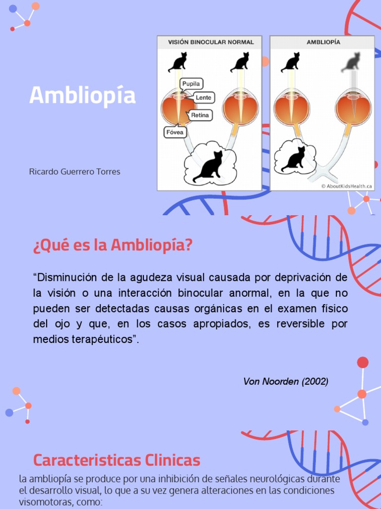 Tipos y causas de ambliopía | PDF | Percepción visual | Causas de la muerte