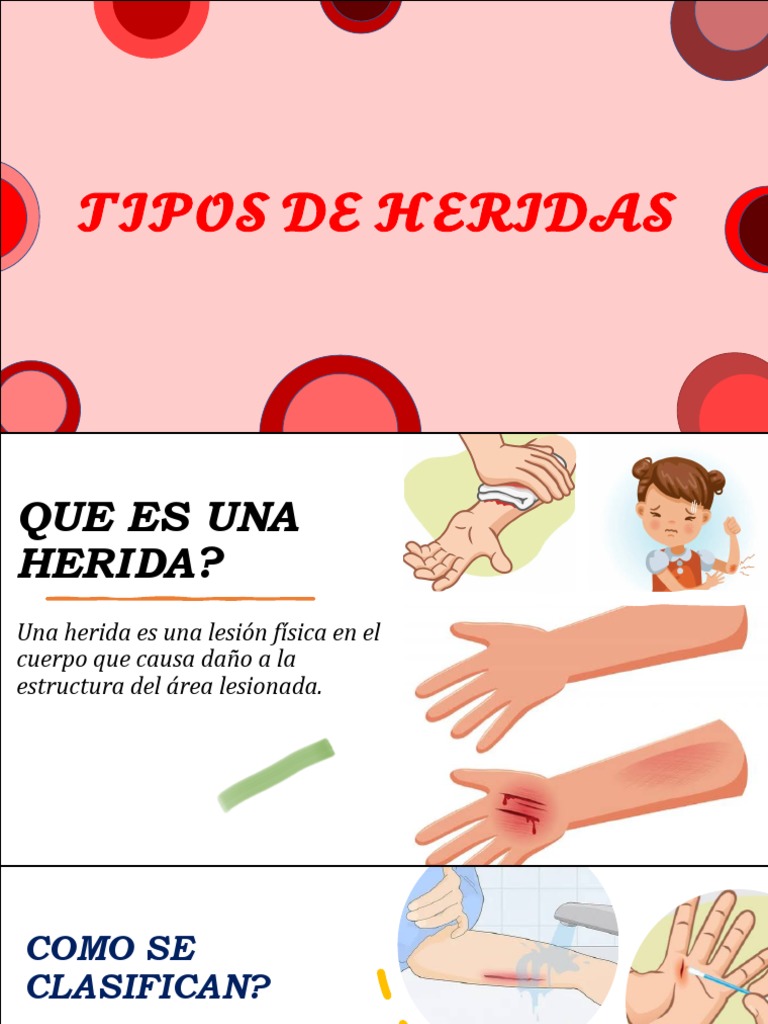 Tipos de Heridas! | PDF