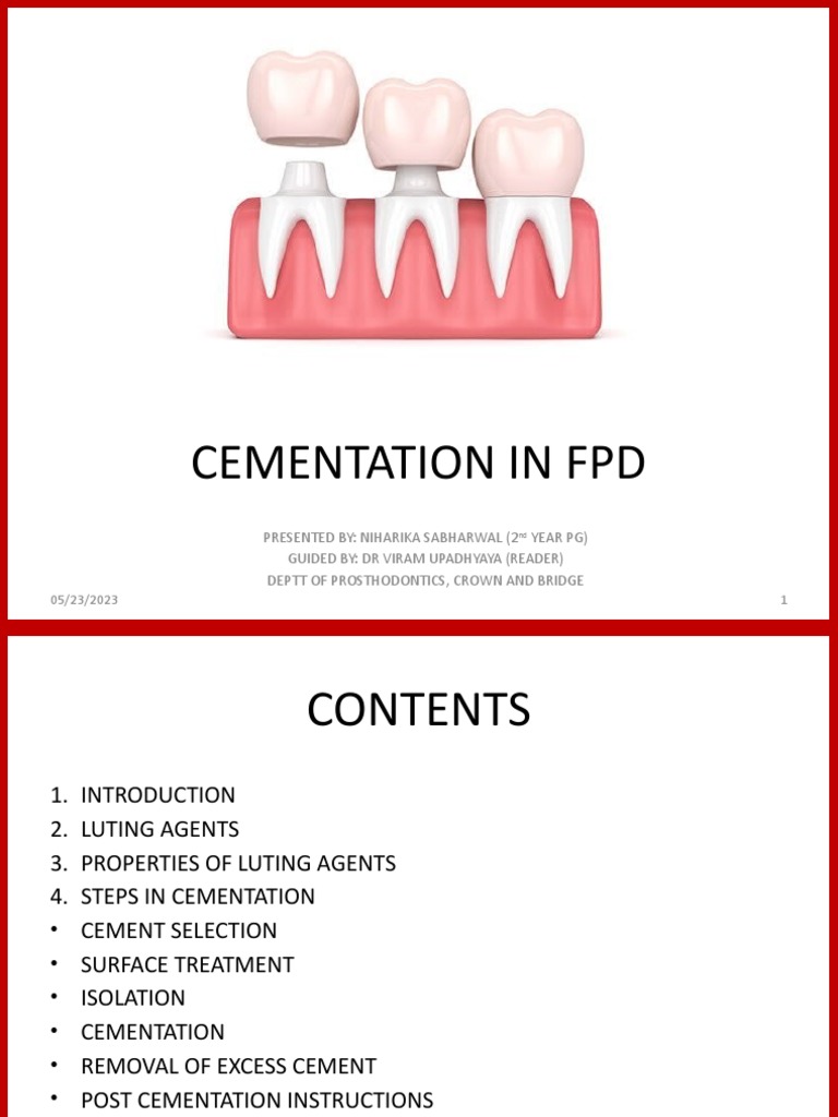 Cementation in FPD | PDF | Materials | Chemistry