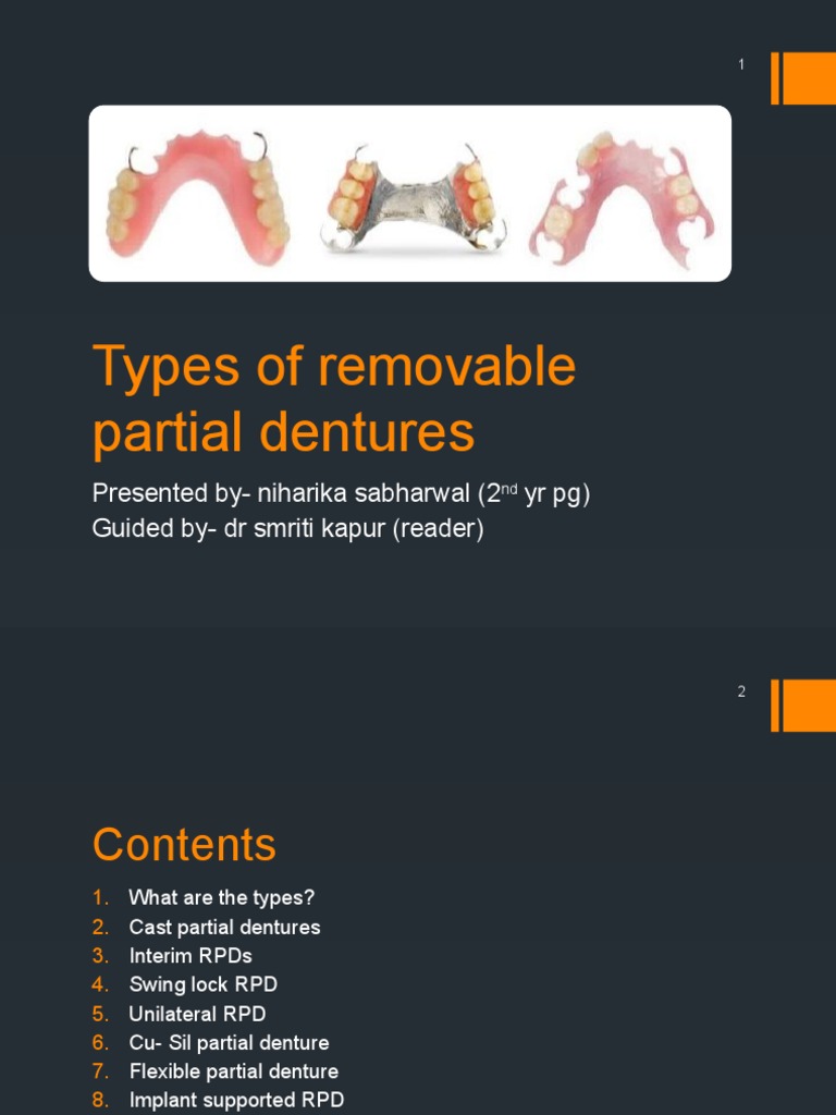 Types of Removable Partial Dentures New | PDF | Dental Implant | Dentures
