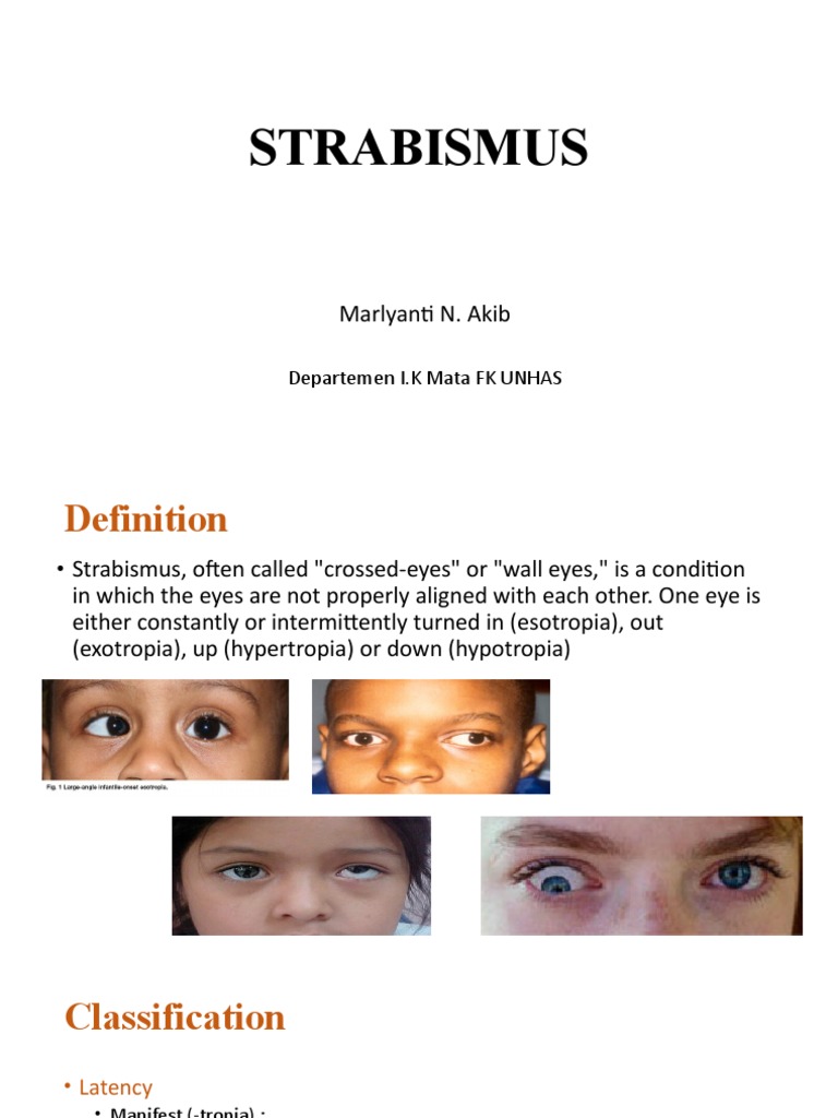 Strabismus | PDF | Vision | Causes Of Death