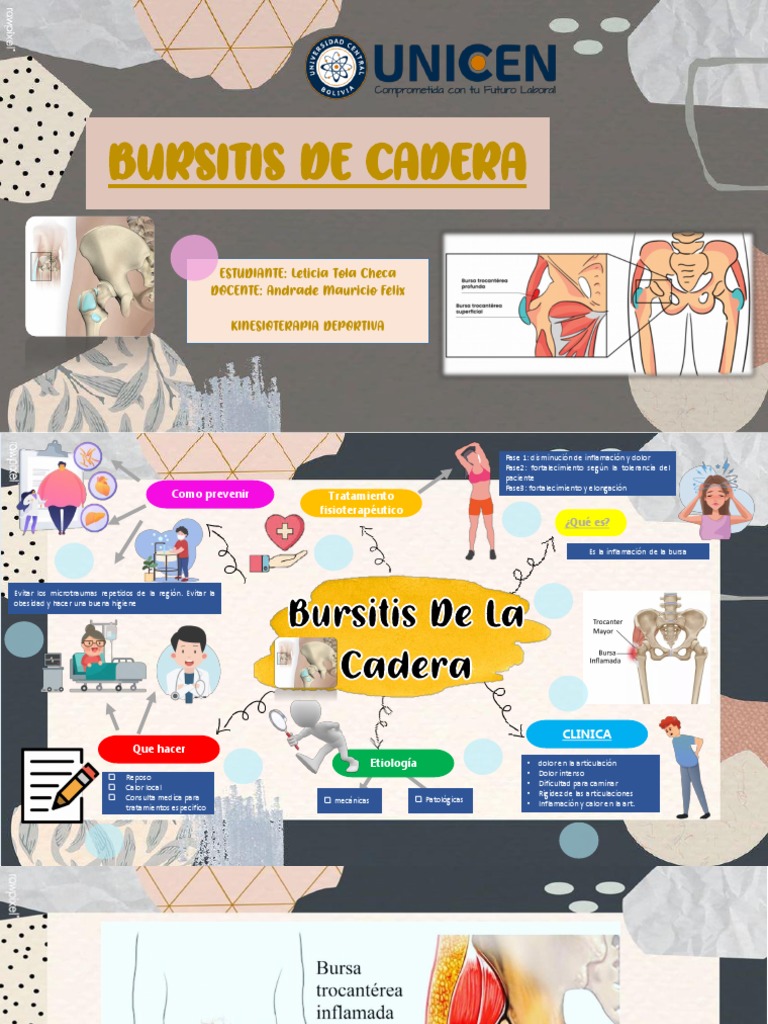 Bursitis de Cadera | PDF