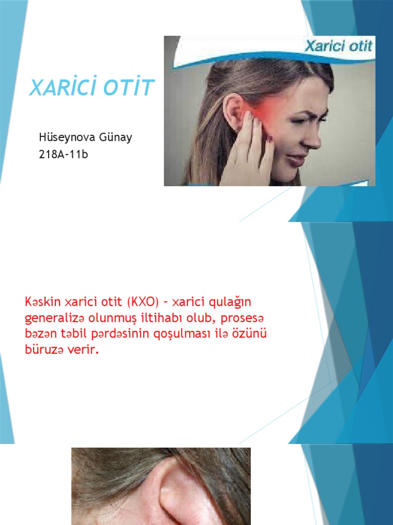 Xarici Otit - HG 1 | PDF