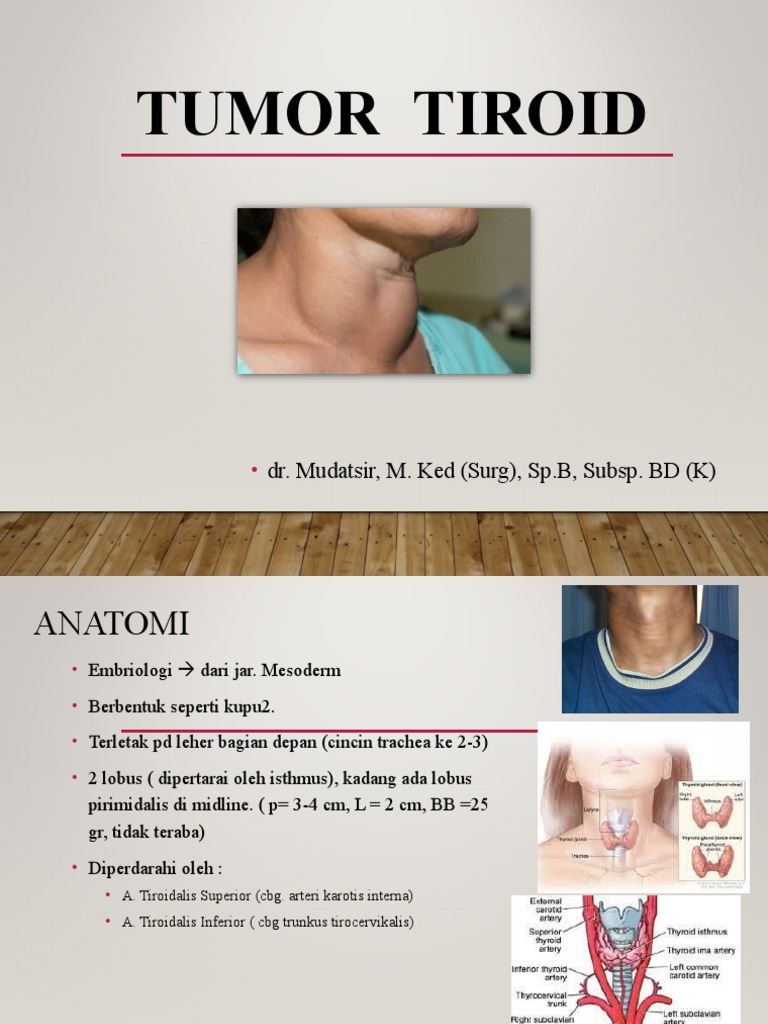 Kuliah Dr. Muda Tumor Tiroid | PDF | Kesehatan Holistik | Sains ...