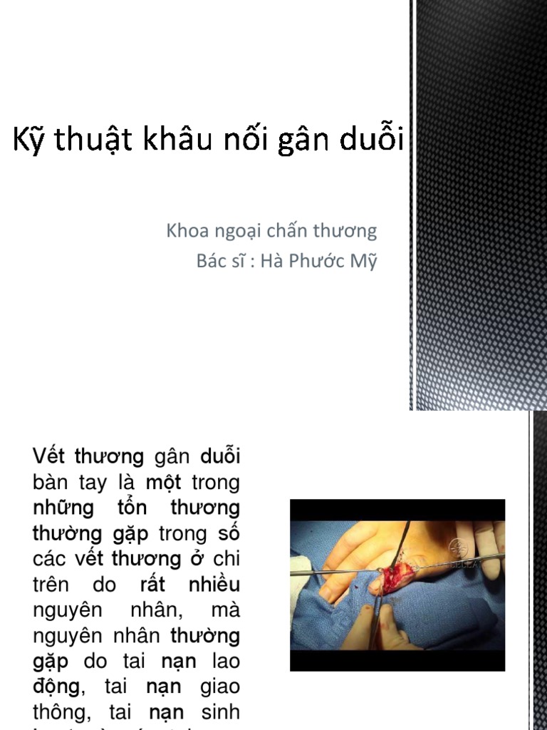 Ky Thuat Khau Noi Gan Duoi | PDF