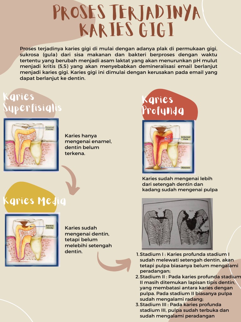 poster proses terjadinya karies klp 2 | PDF