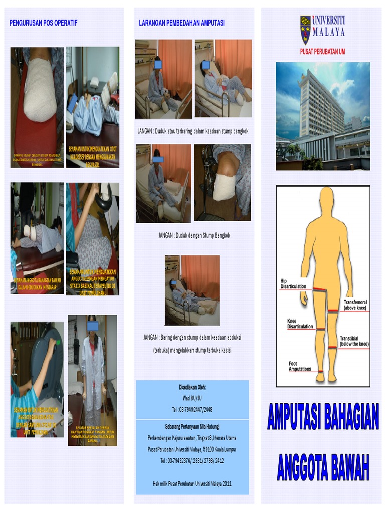 Amputasi Bahagian Anggota Bawah | PDF