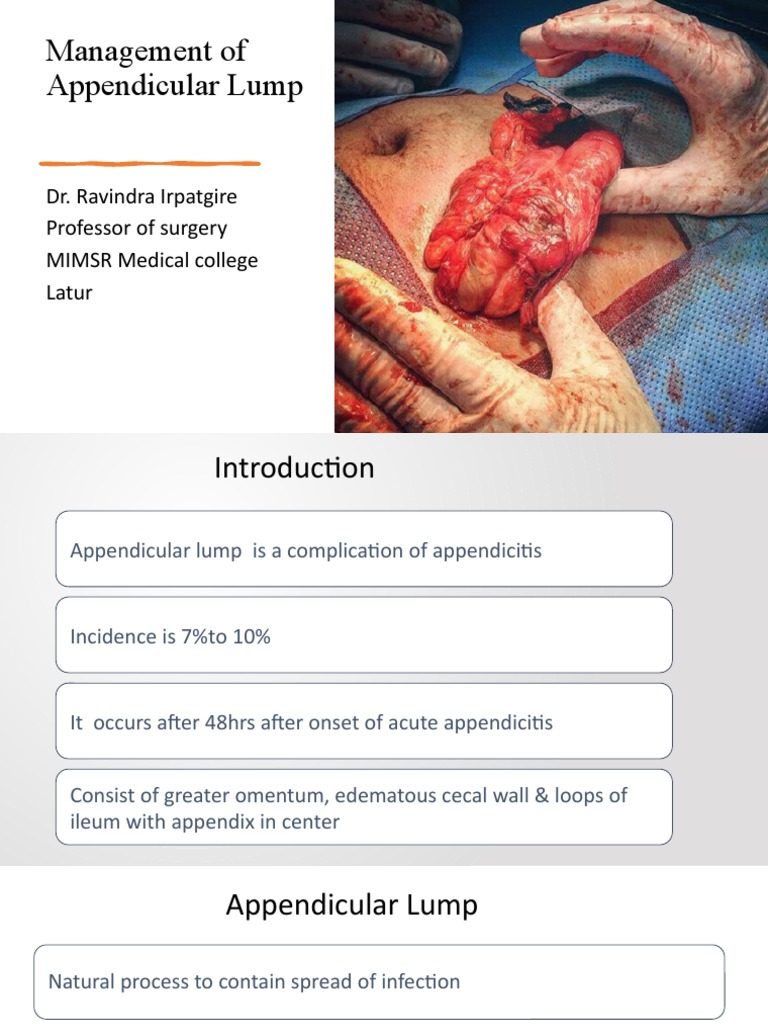 Ravindra Irpatgire Appendix Lump | PDF | Surgery | Epidemiology