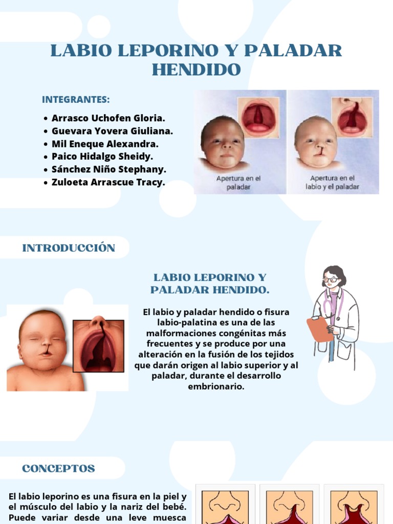 Labio Leporino Expo | PDF | La leche materna | Anatomía humana
