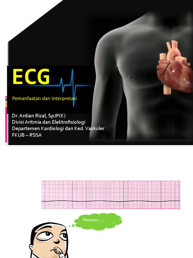 Slide Ekg Perki | PDF