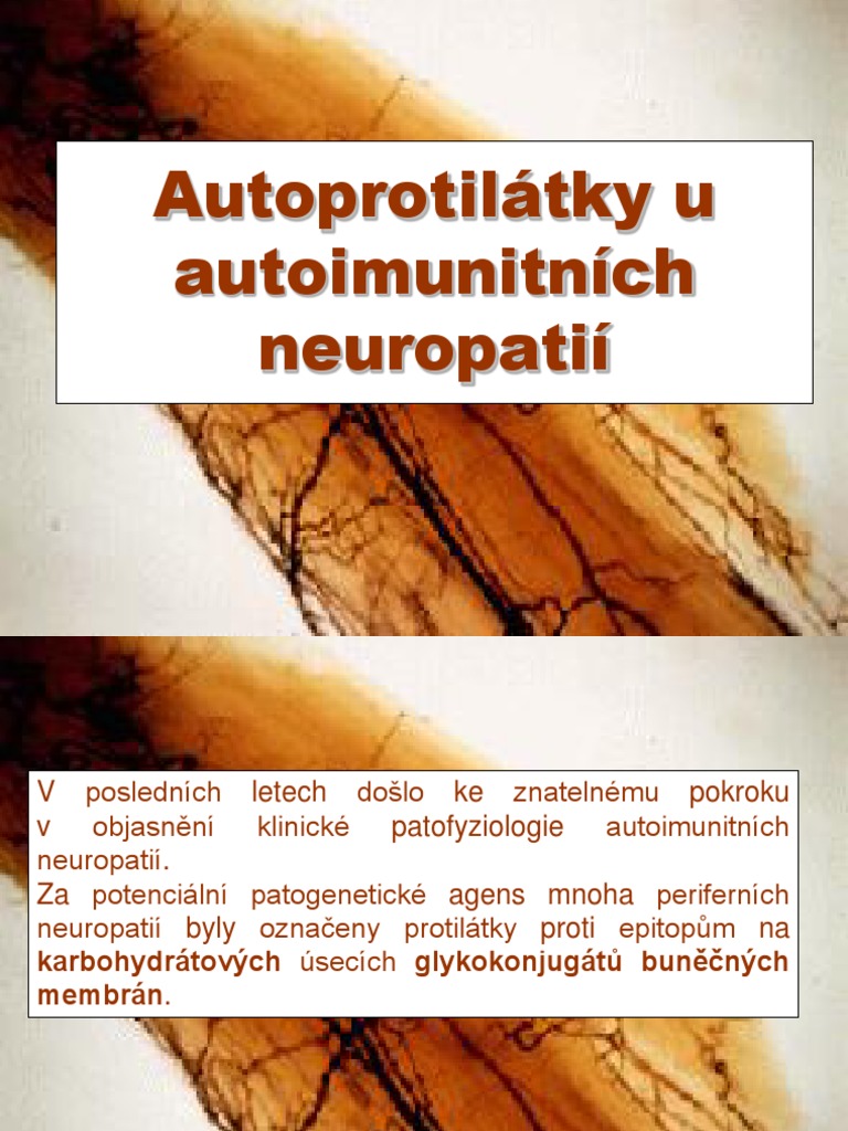 Autoimunitni Neuropatie | PDF