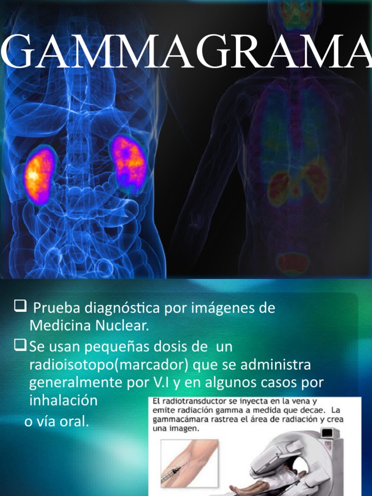 Gammagrama 1551 | PDF | Tiroides | Metástasis