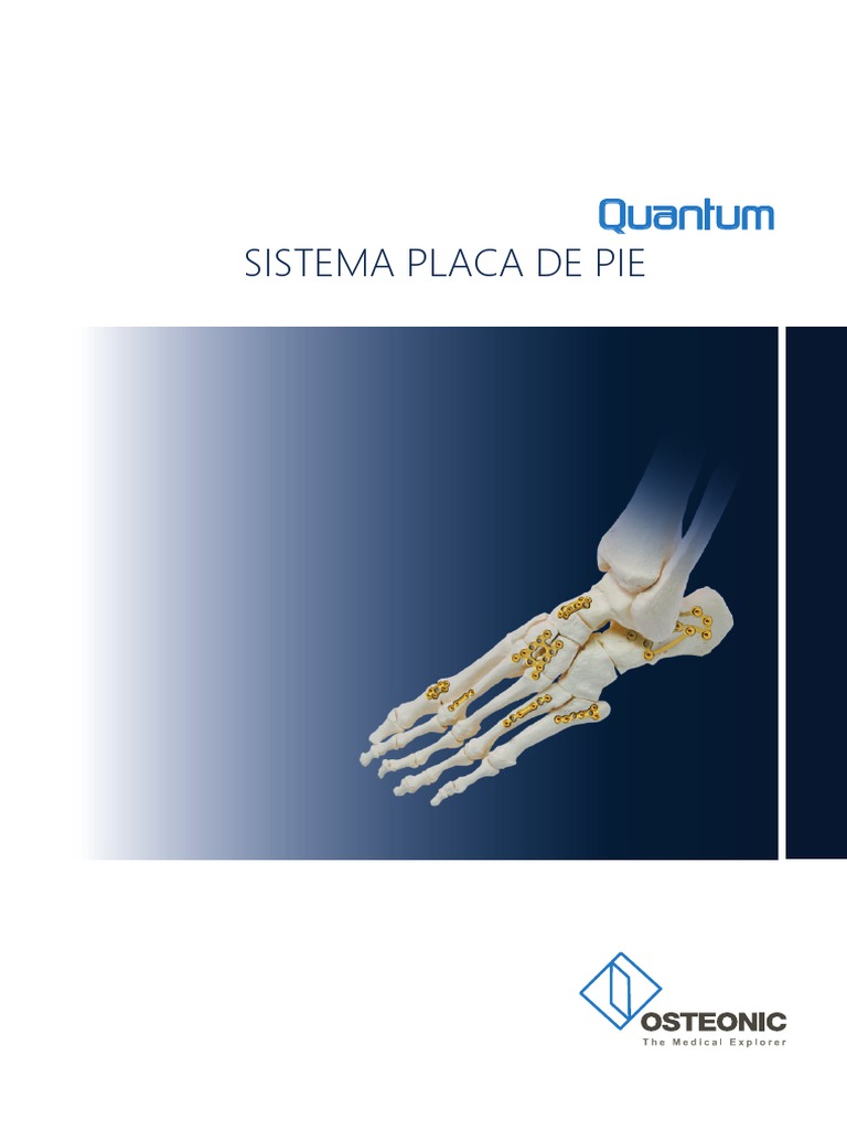 Ficha Tecnica Sistema Tecno-Foot Osteonic | PDF