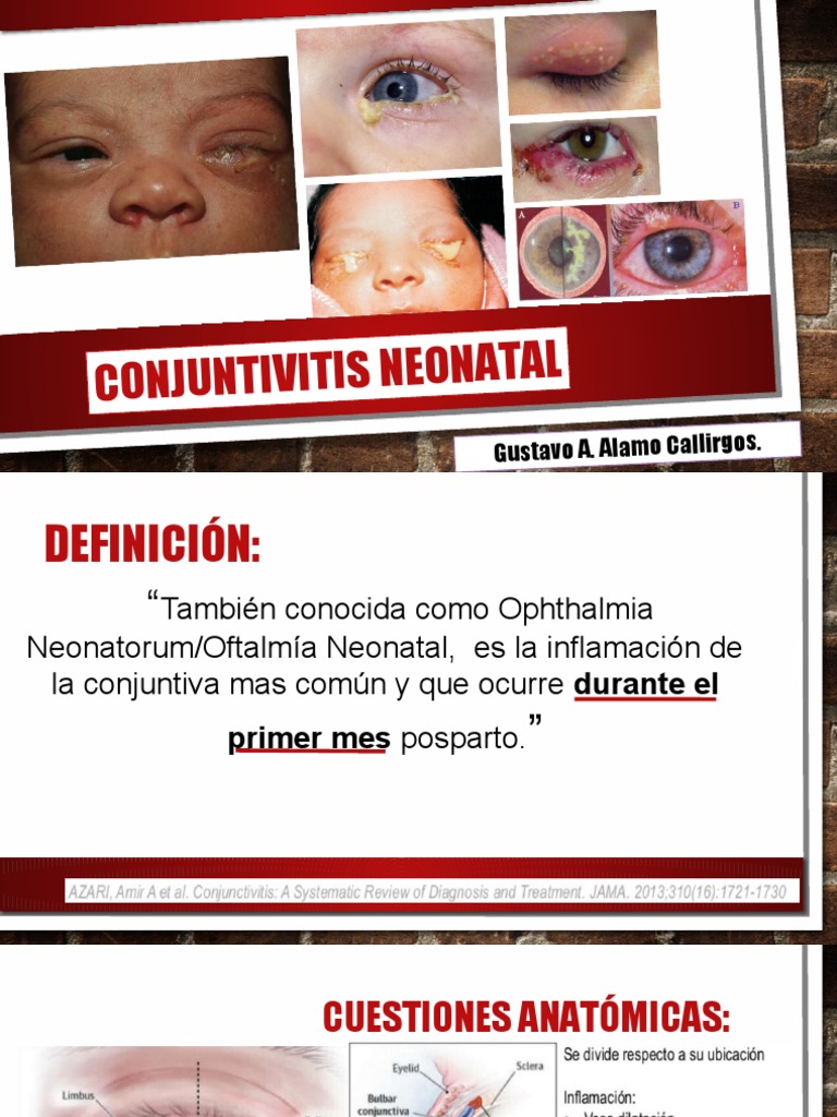 Conjuntivitis Neonatal: Causas y Tratamiento | PDF | Microbiología ...