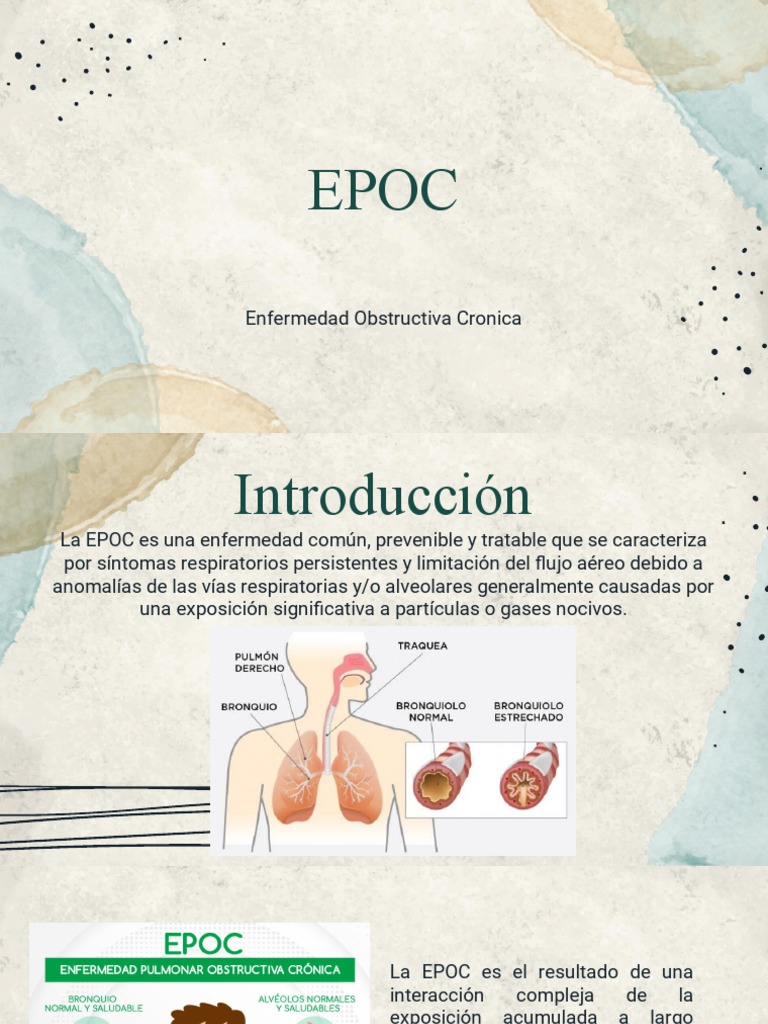 EPOC | PDF