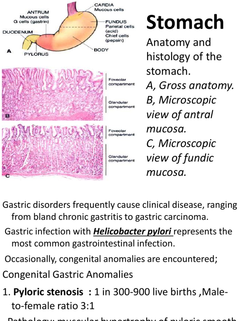 GIT 1 - Stomach | Download Free PDF | Stomach | Inflammation
