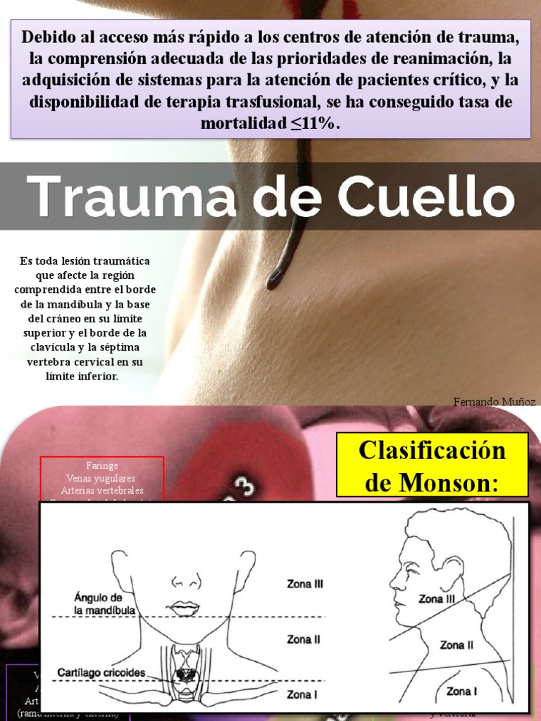 Trauma de Cuello | PDF | Lesión | Cuello