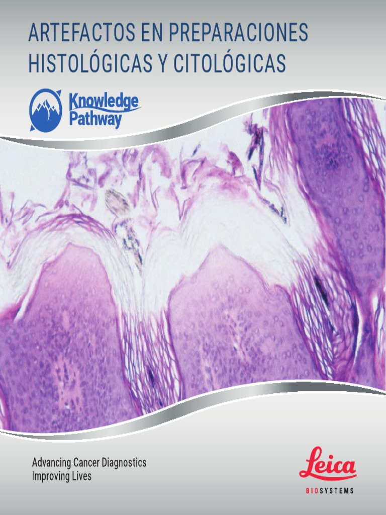 Knowledge Pathway Artifacts in Histological and Cytological Prep | PDF ...