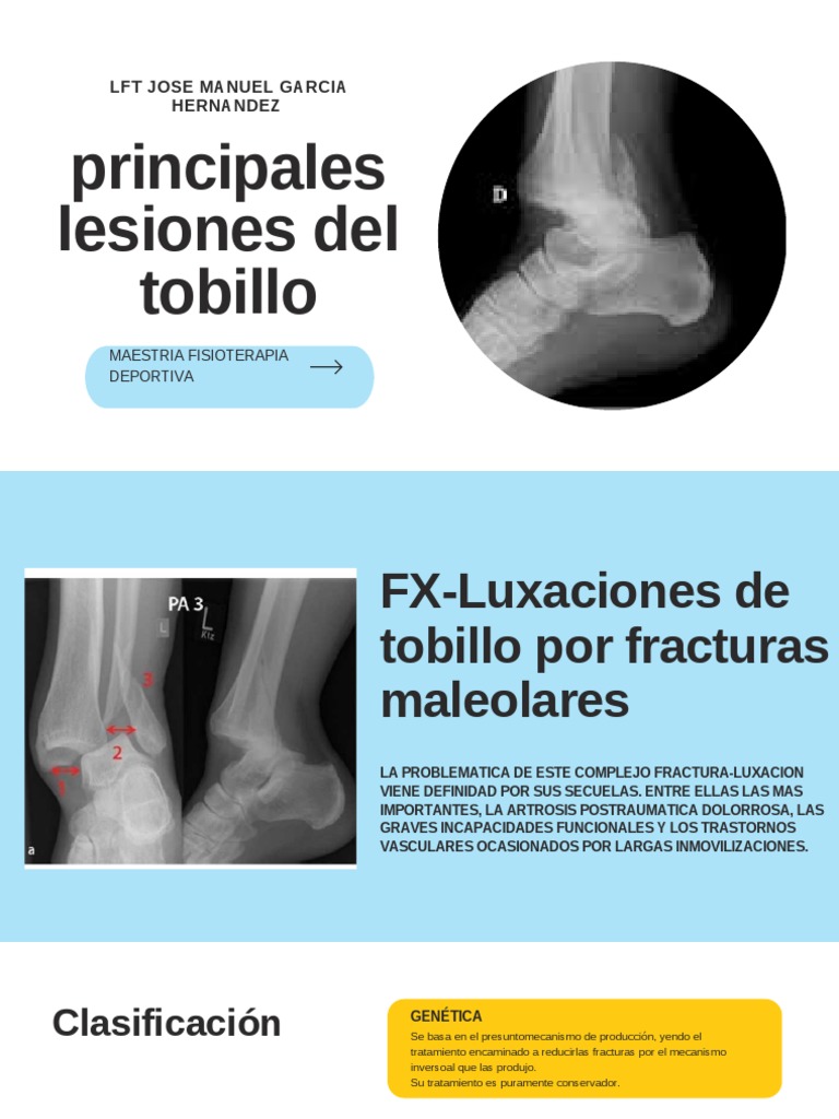 Lesiones de Tobillo | PDF | Tobillo | Medicina CLINICA