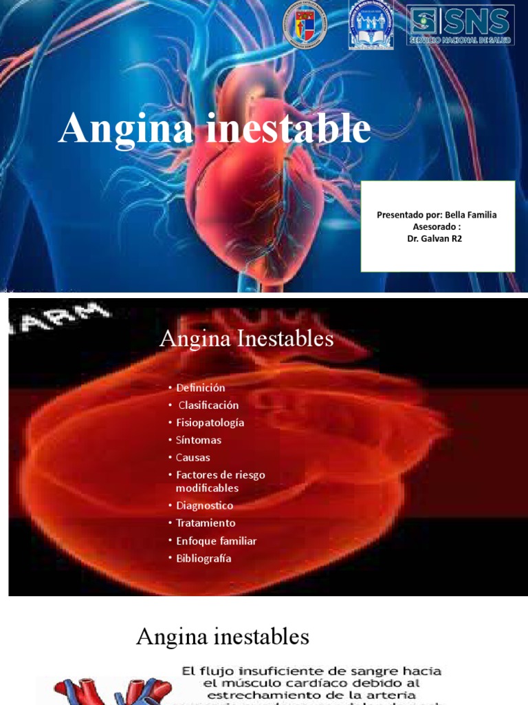 Angina Inestables | PDF
