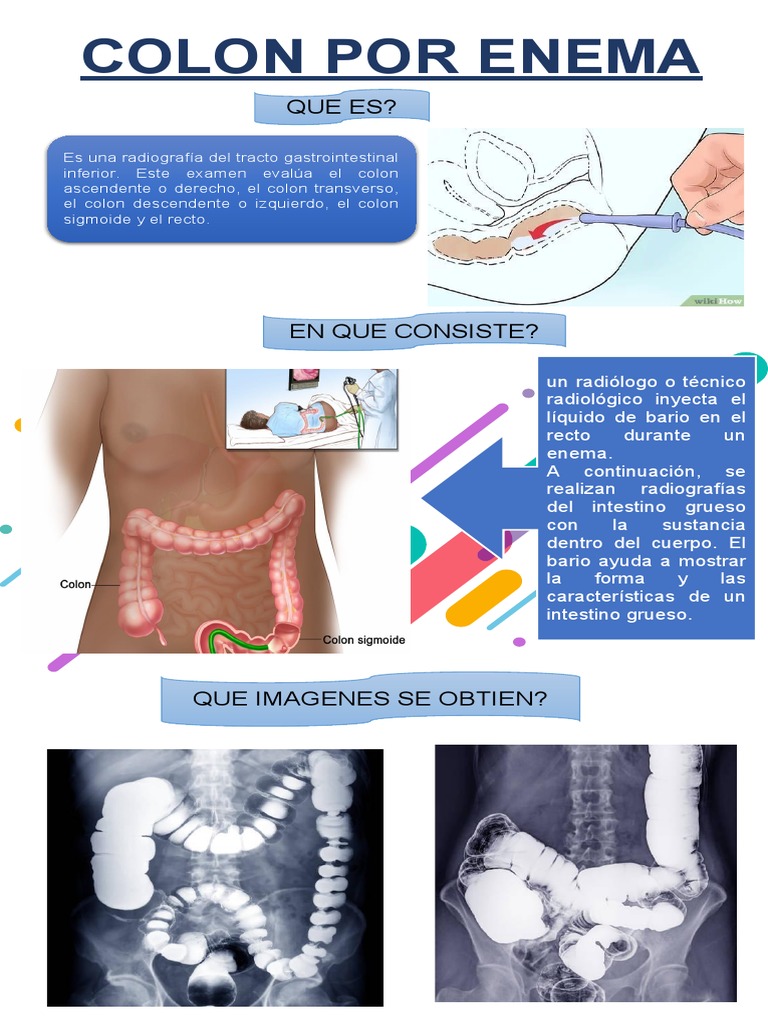 Colon Por Enema-Urografía | PDF | Vejiga urinaria | Especialidades Medicas