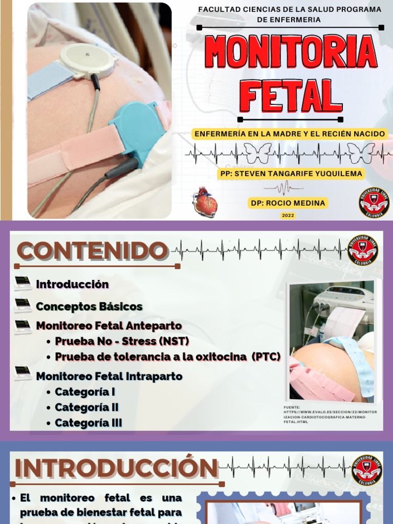 Monitoria Fetal | PDF | Parto | Especialidades Medicas