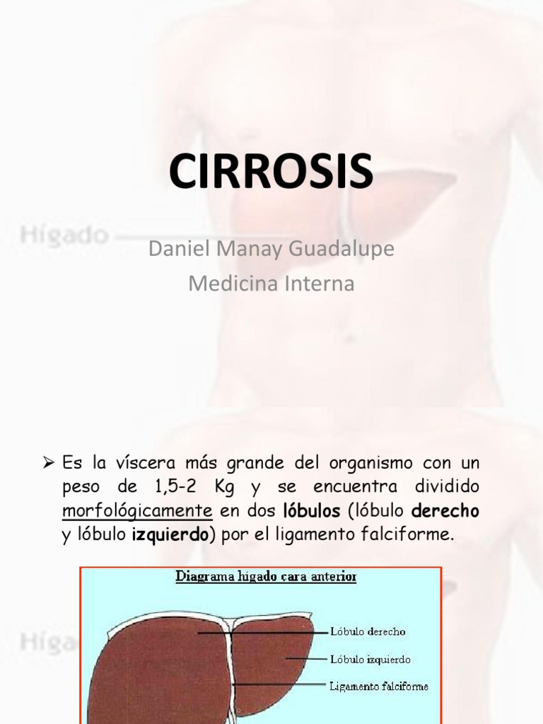 Cirrosis Hepática y Ascitis en Pacientes | PDF | Hígado | Órgano (anatomía)