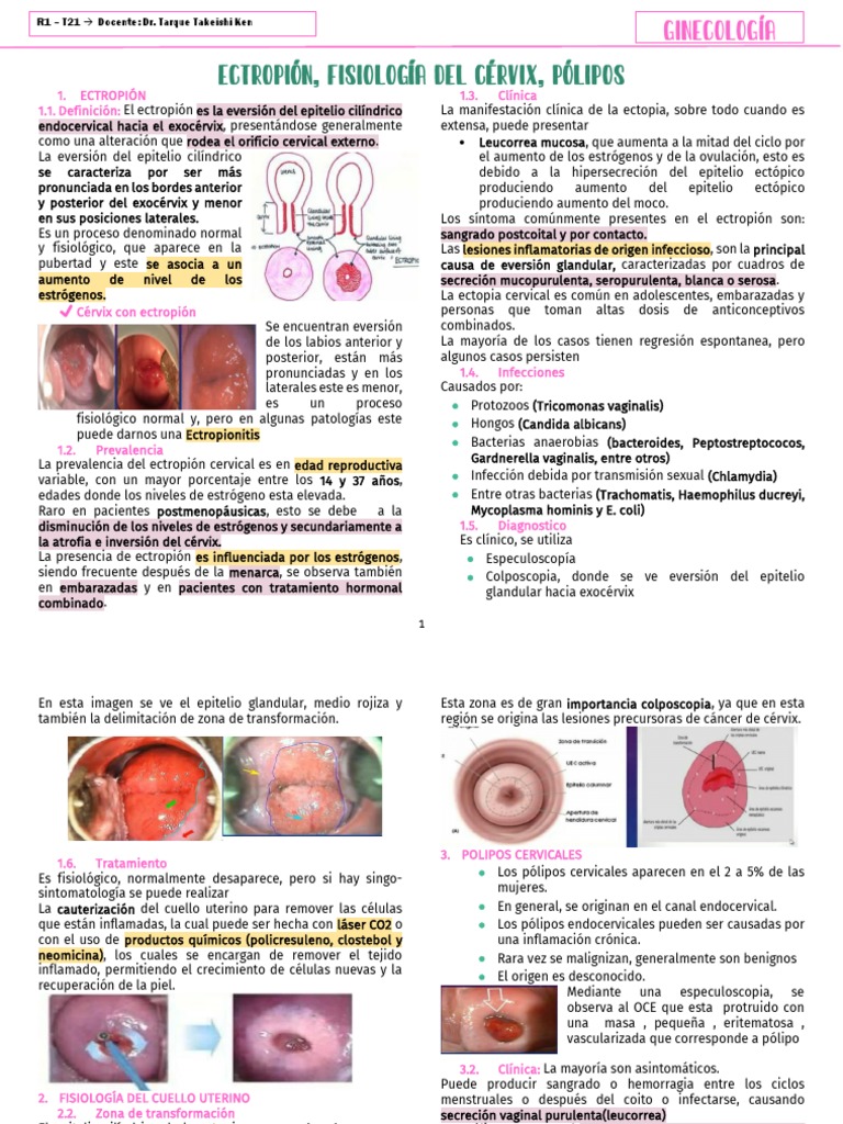 Ectropión y Pólipos Cervicales: Guía Clínica | PDF | Salud pública ...